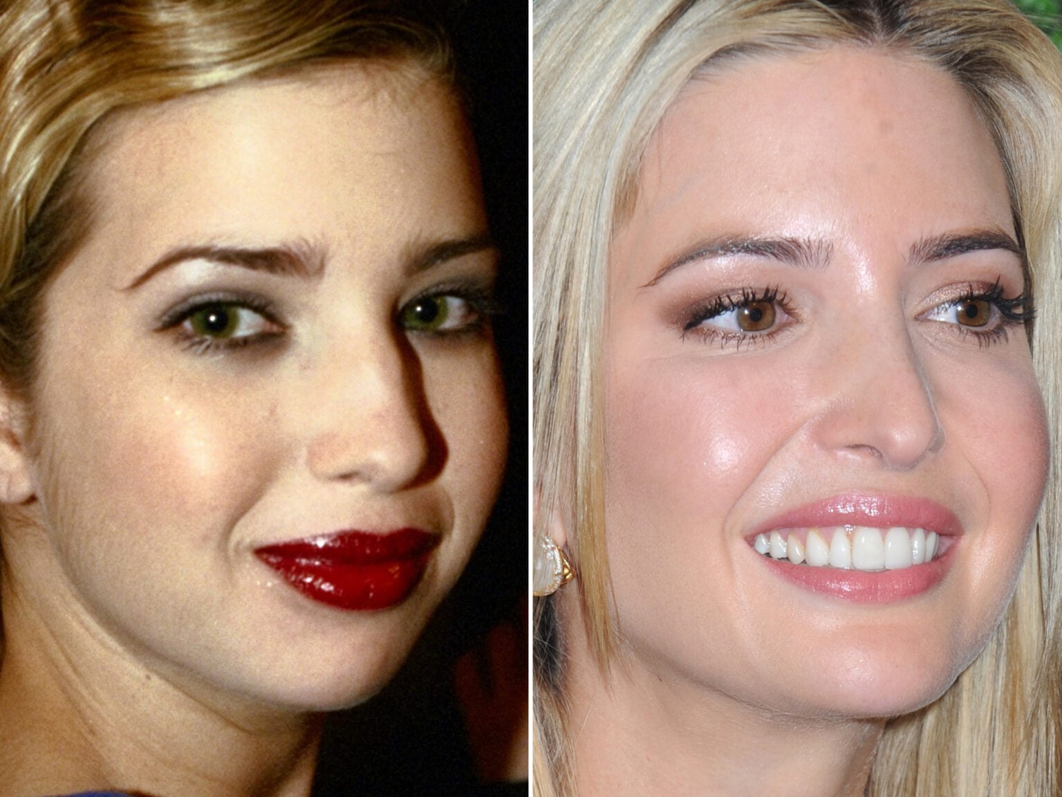 Ivanka Trump Before and After: From 1995 to 2022