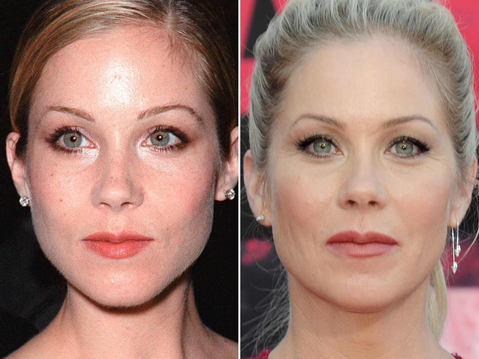 Christina Applegate Before and After