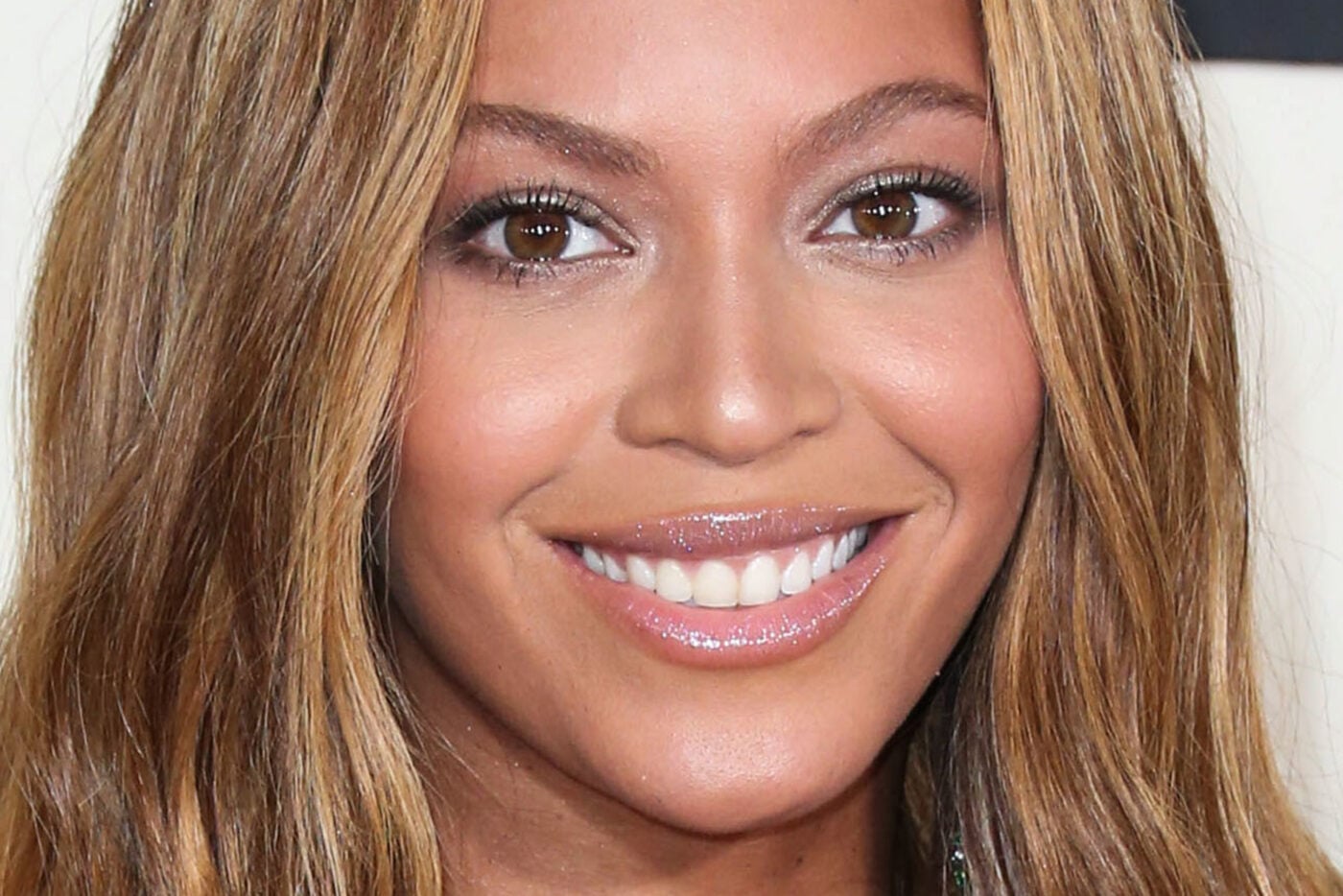 Beyonce Teeth Before and After: The Truth About That Perfect Smile ...