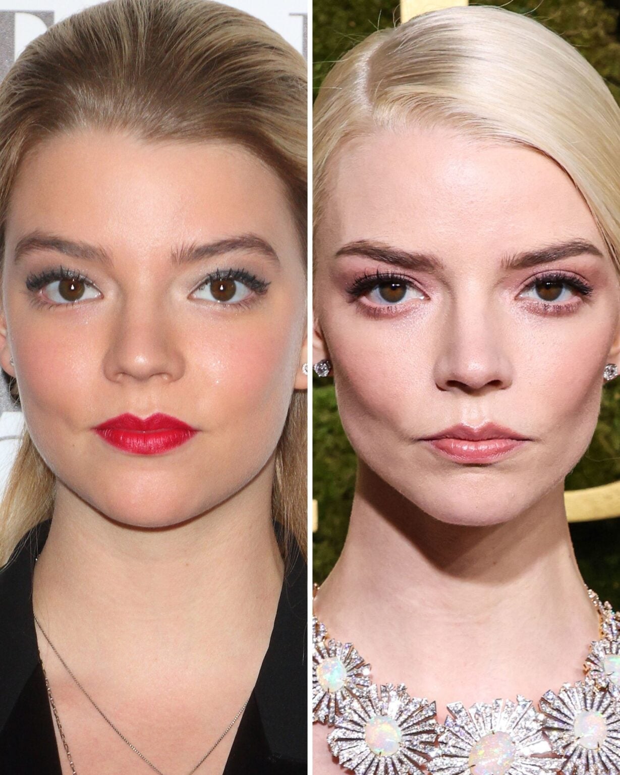 Anya Taylor-Joy Before and After: Plastic Surgery Rumors